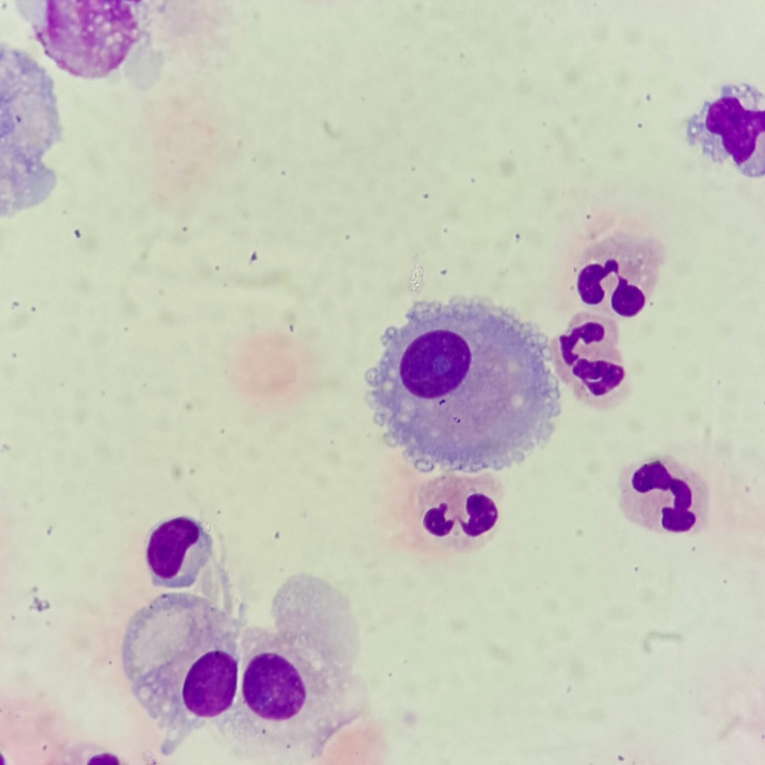 Mesothelial Cells - MedLabBuddy