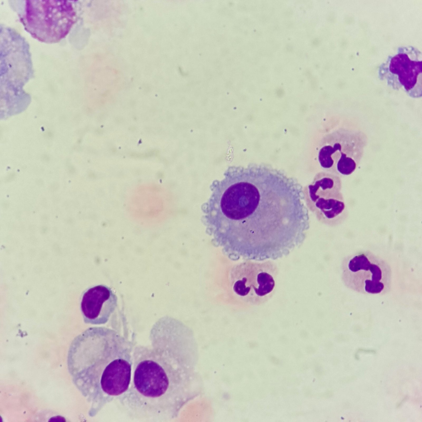 Mesothelial Cells - MedLabBuddy