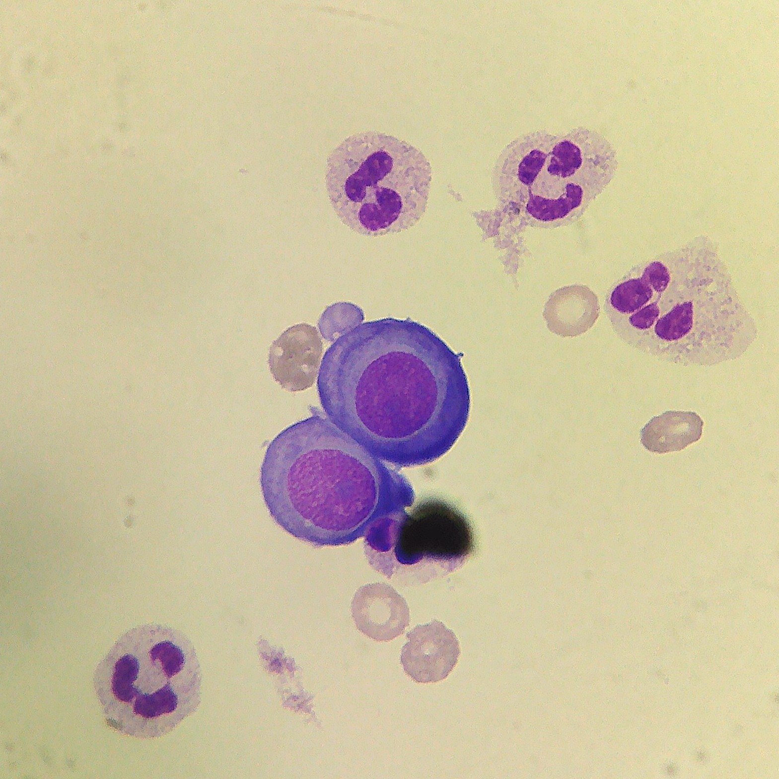 Mesothelial Cells - MedLabBuddy