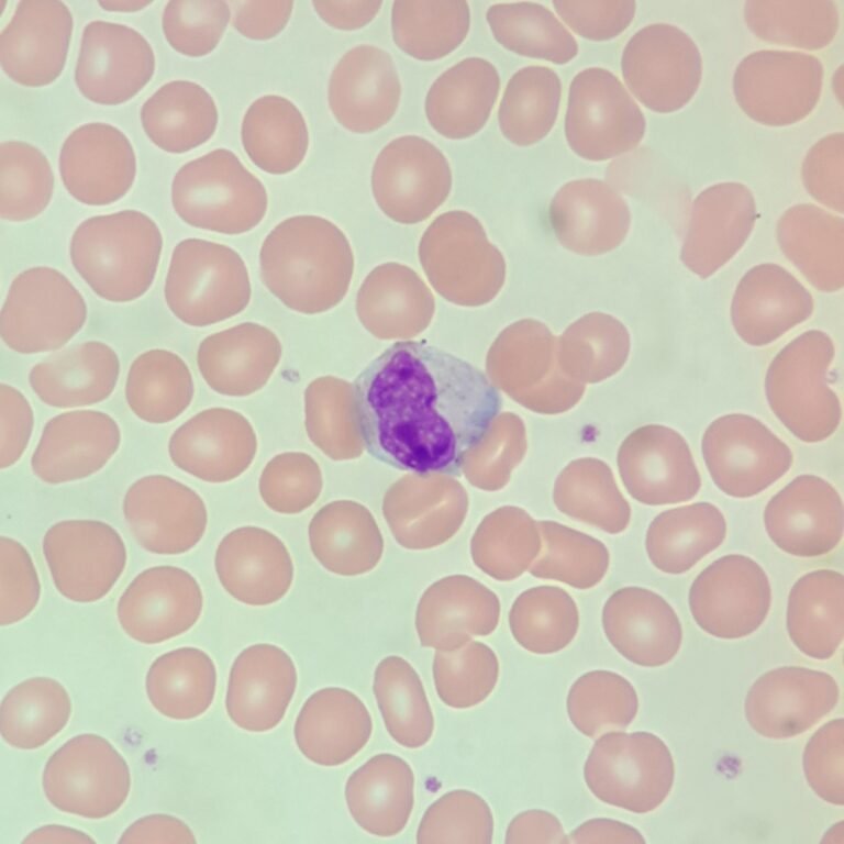 Metamyelocytes: Identification & Differentiation