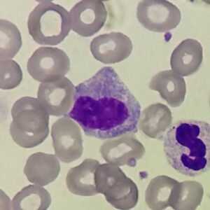 Metamyelocytes: Identification & Differentiation