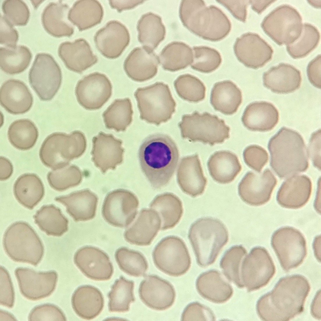 Red Blood Cell Lineage: Identification & Differentiation
