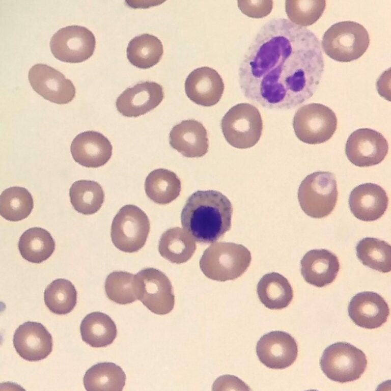 Red Blood Cell Lineage: Identification & Differentiation