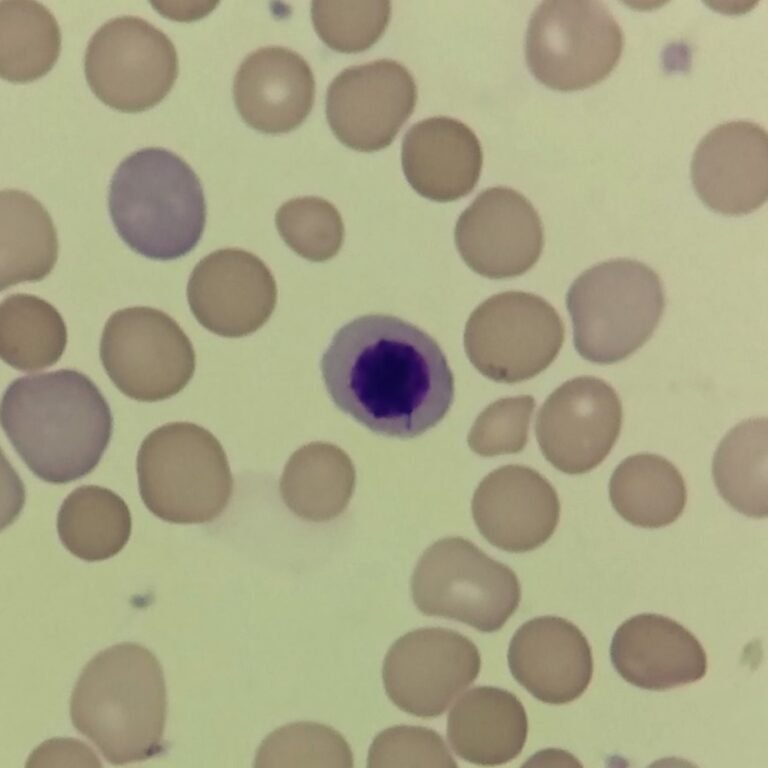 Red Blood Cell Lineage: Identification & Differentiation