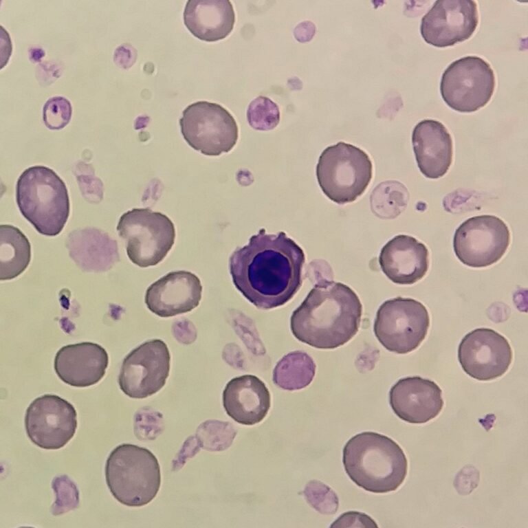 Red Blood Cell Lineage: Identification & Differentiation