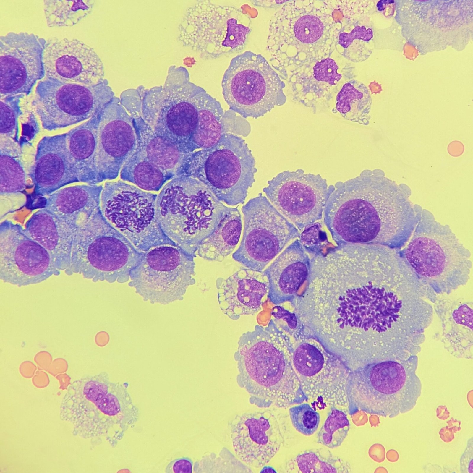 Mitotic Figures - MedLabBuddy