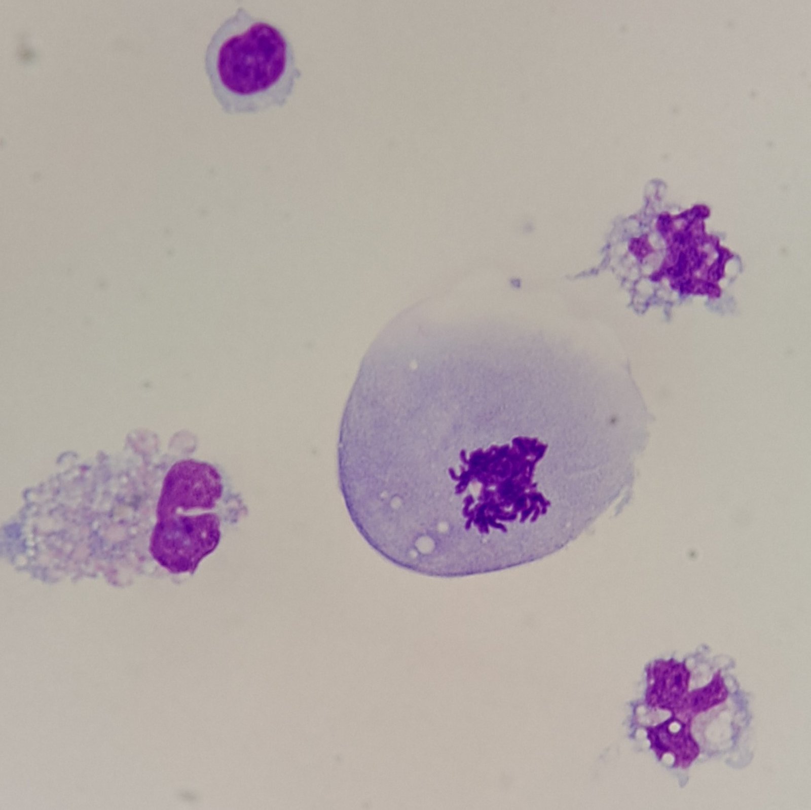 Mitotic Figures - MedLabBuddy
