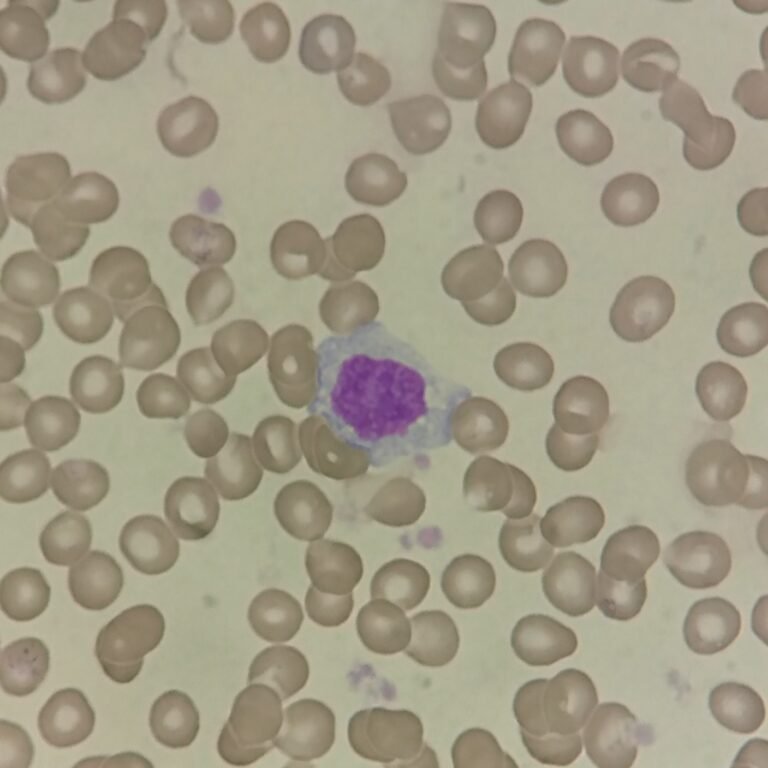 Monocytes: Identification & Differentiation