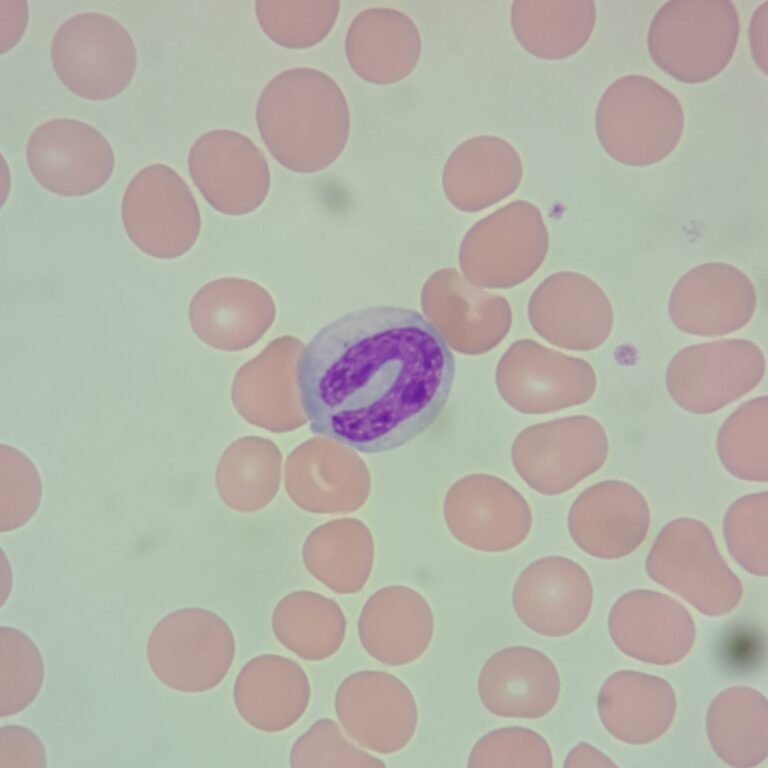 Monocytes: Identification & Differentiation