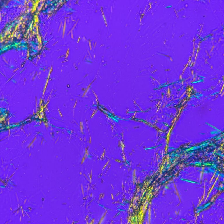 Body Fluid Crystals: Identification and Clinical Significance