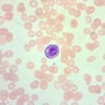 Myelocytes: Identification & Differentiation