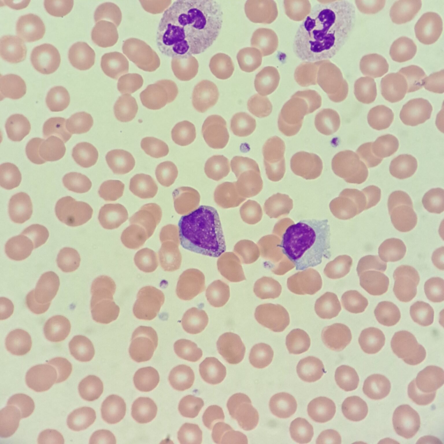 Myelocytes: Identification & Differentiation