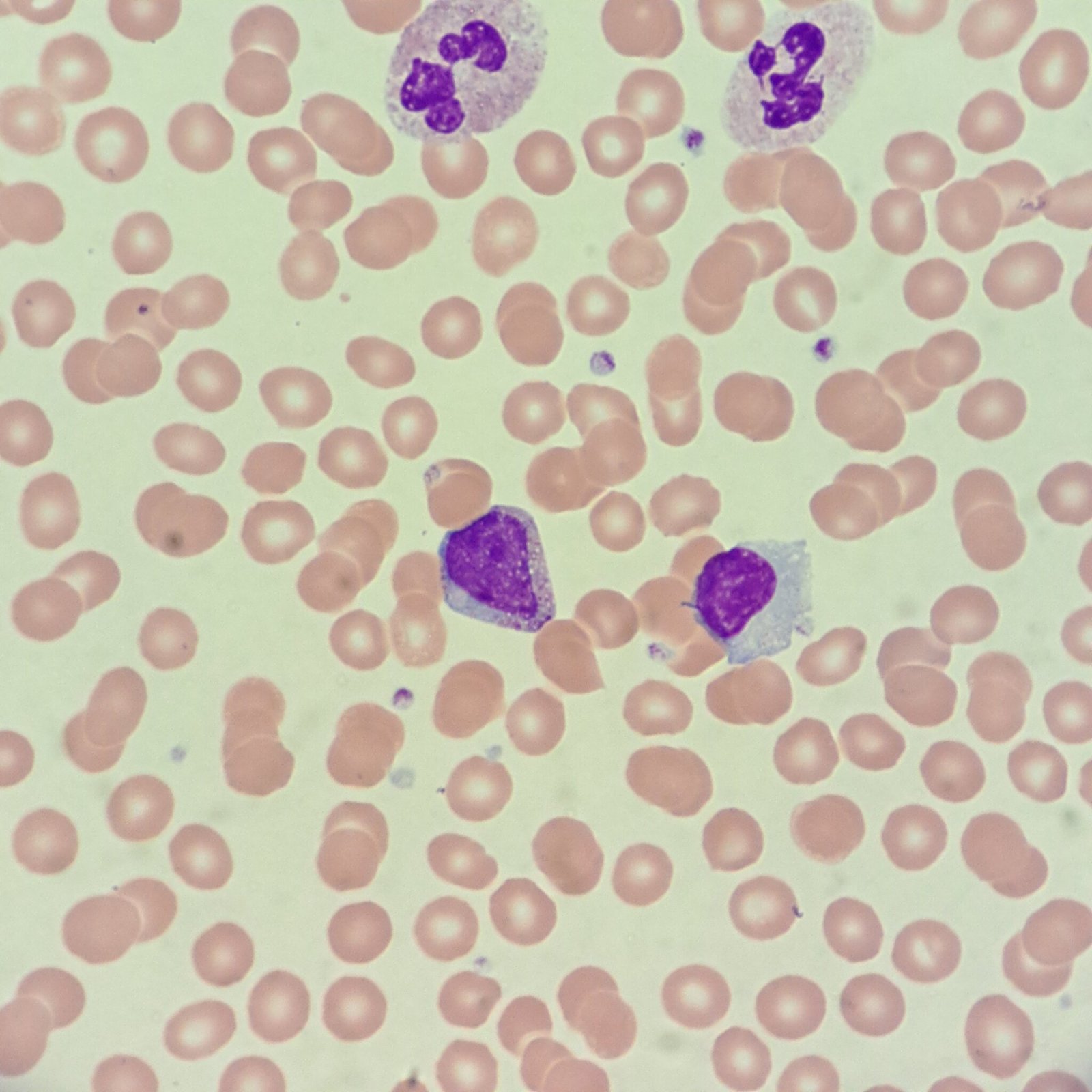 Myelocytes: Identification & Differentiation