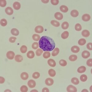 Myelocytes: Identification & Differentiation