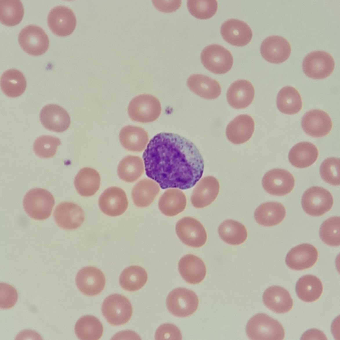 Myelocytes: Identification & Differentiation