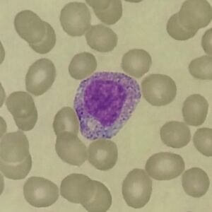 Myelocytes: Identification & Differentiation