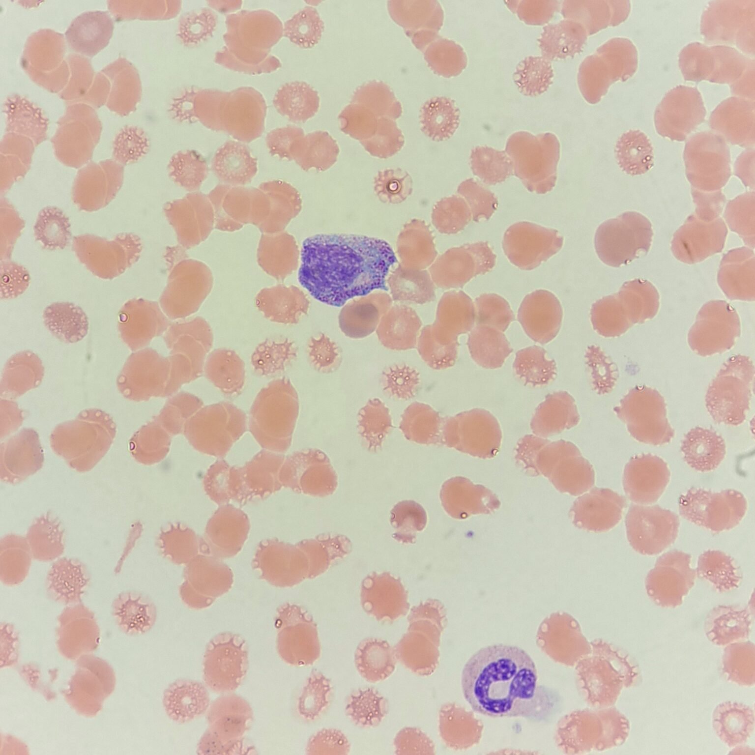 Myelocytes: Identification & Differentiation