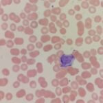Myelocytes: Identification & Differentiation
