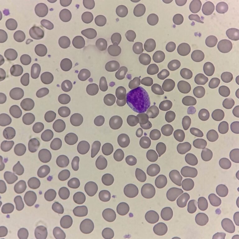 Myelocytes: Identification & Differentiation