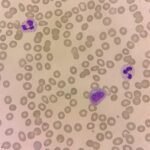 Myelocytes: Identification & Differentiation