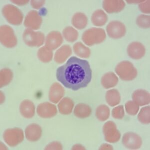 Red Blood Cell Lineage: Identification & Differentiation