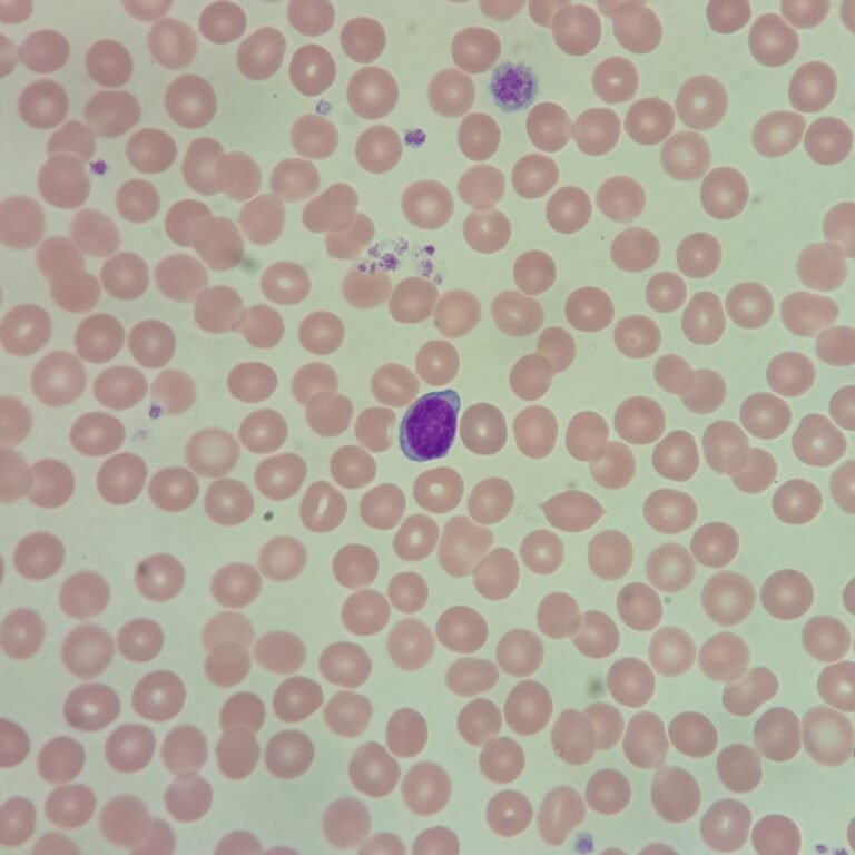 RBC Morphology Based on Indices