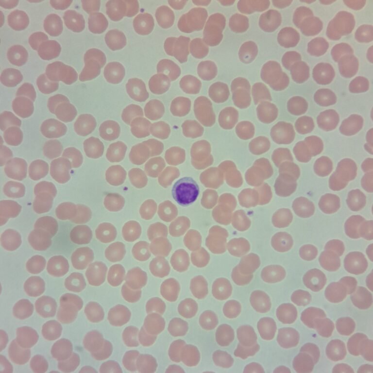 RBC Morphology Based on Indices