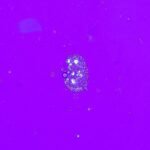 Oval Fat Bodies - MedLabBuddy