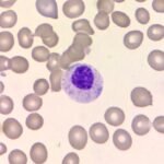 Neutrophil Inclusions & Abnormalities