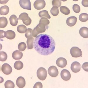 Neutrophil Inclusions & Abnormalities