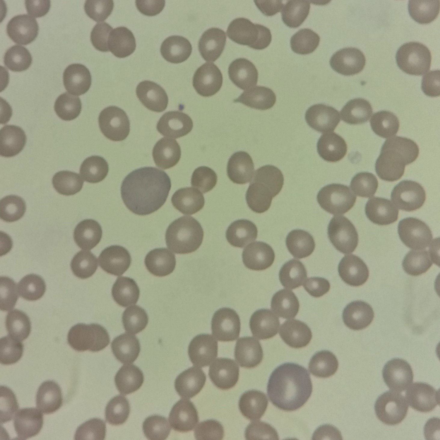 Polychromasia - MedLabBuddy