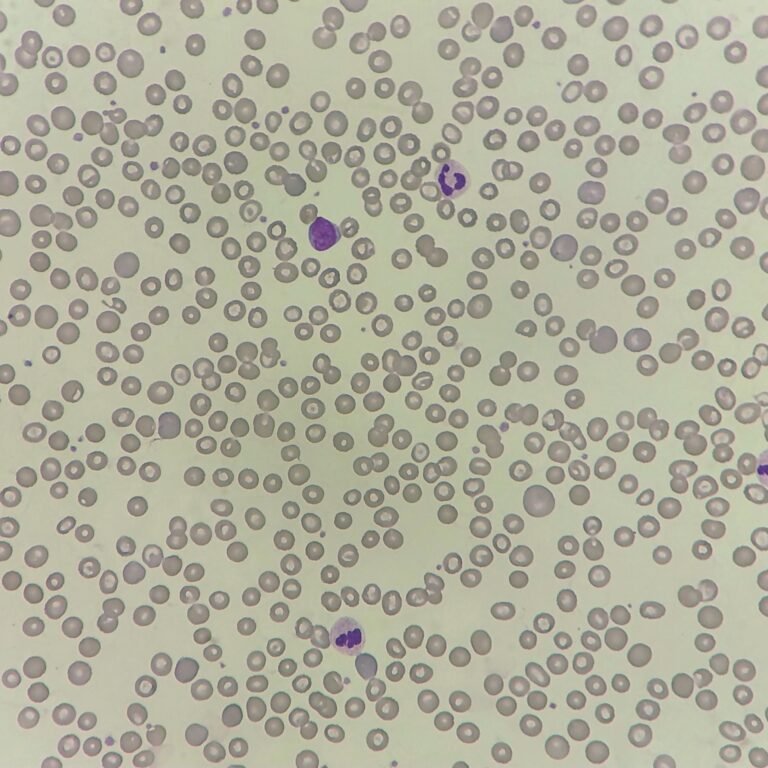 Polychromasia - MedLabBuddy