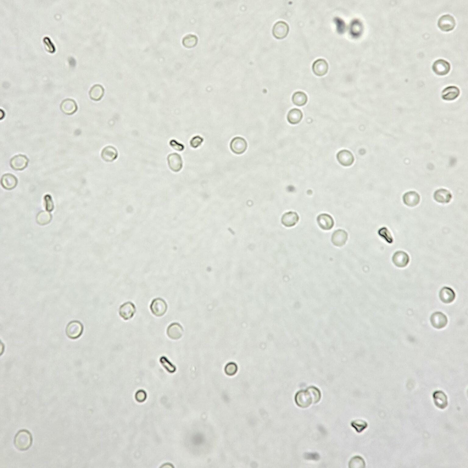 RBCs in Urine & Their Lookalikes - MedLabBuddy
