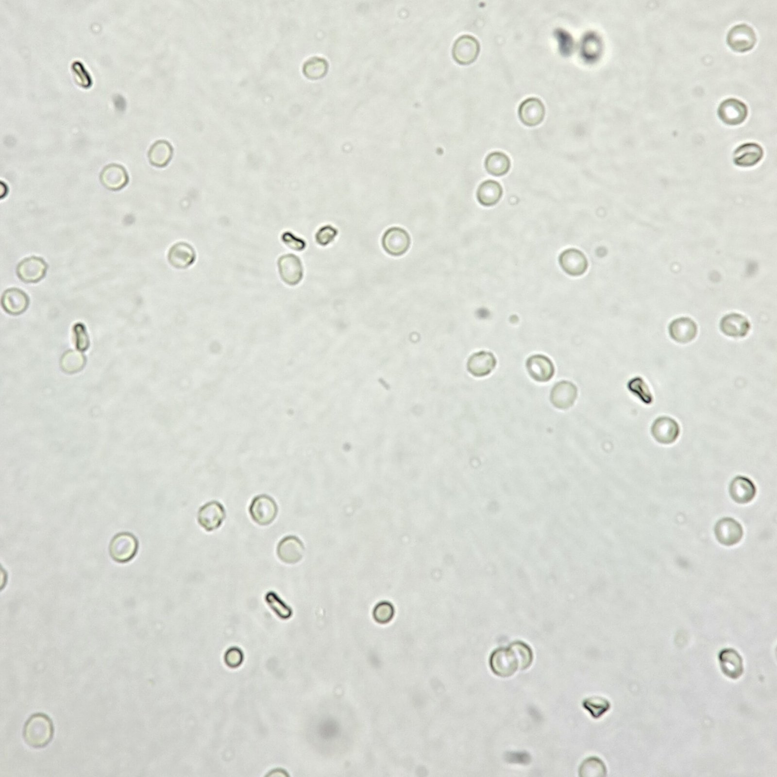 RBCs in Urine & Their Lookalikes - MedLabBuddy