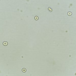 RBCs in Urine & Their Lookalikes - MedLabBuddy