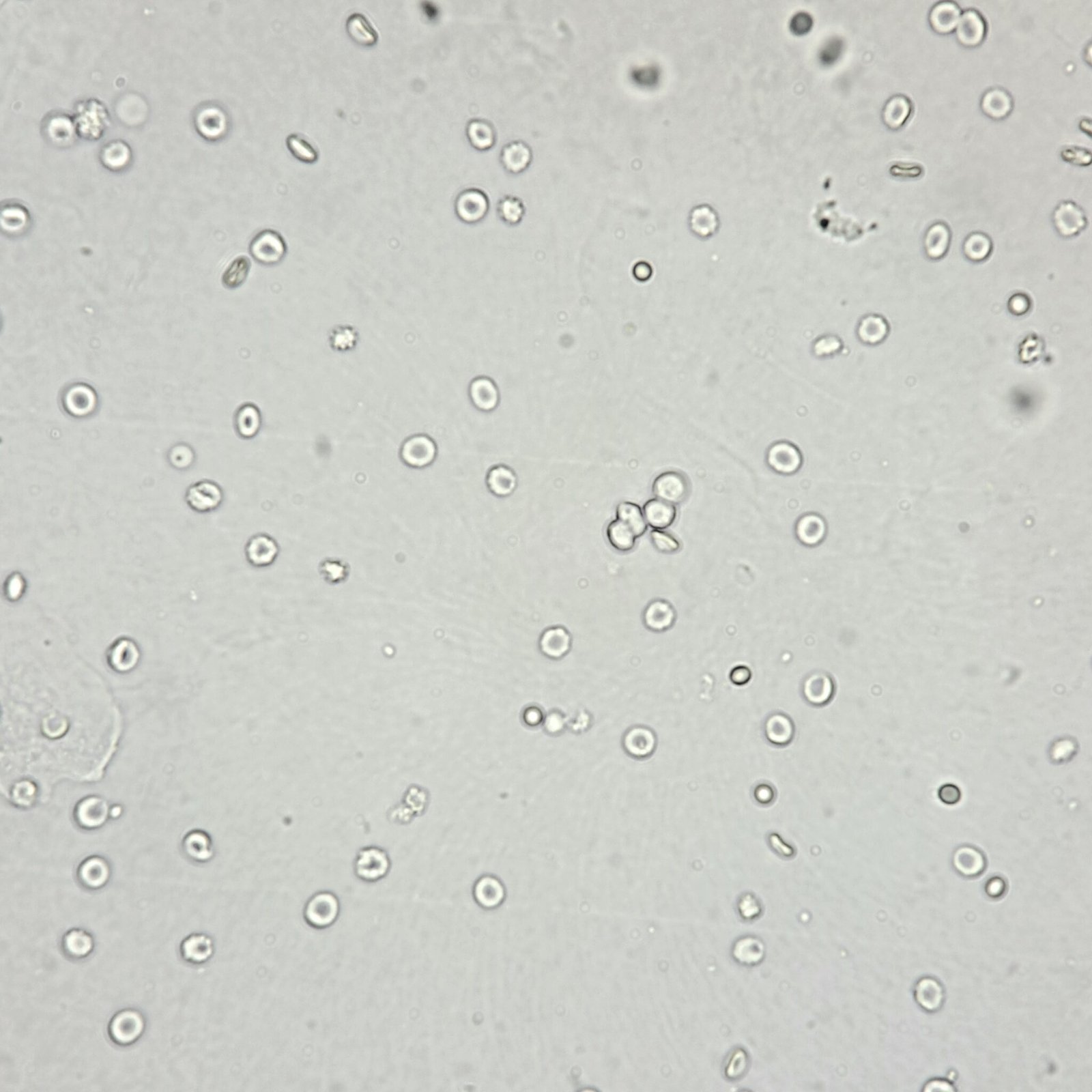 RBCs in Urine & Their Lookalikes - MedLabBuddy