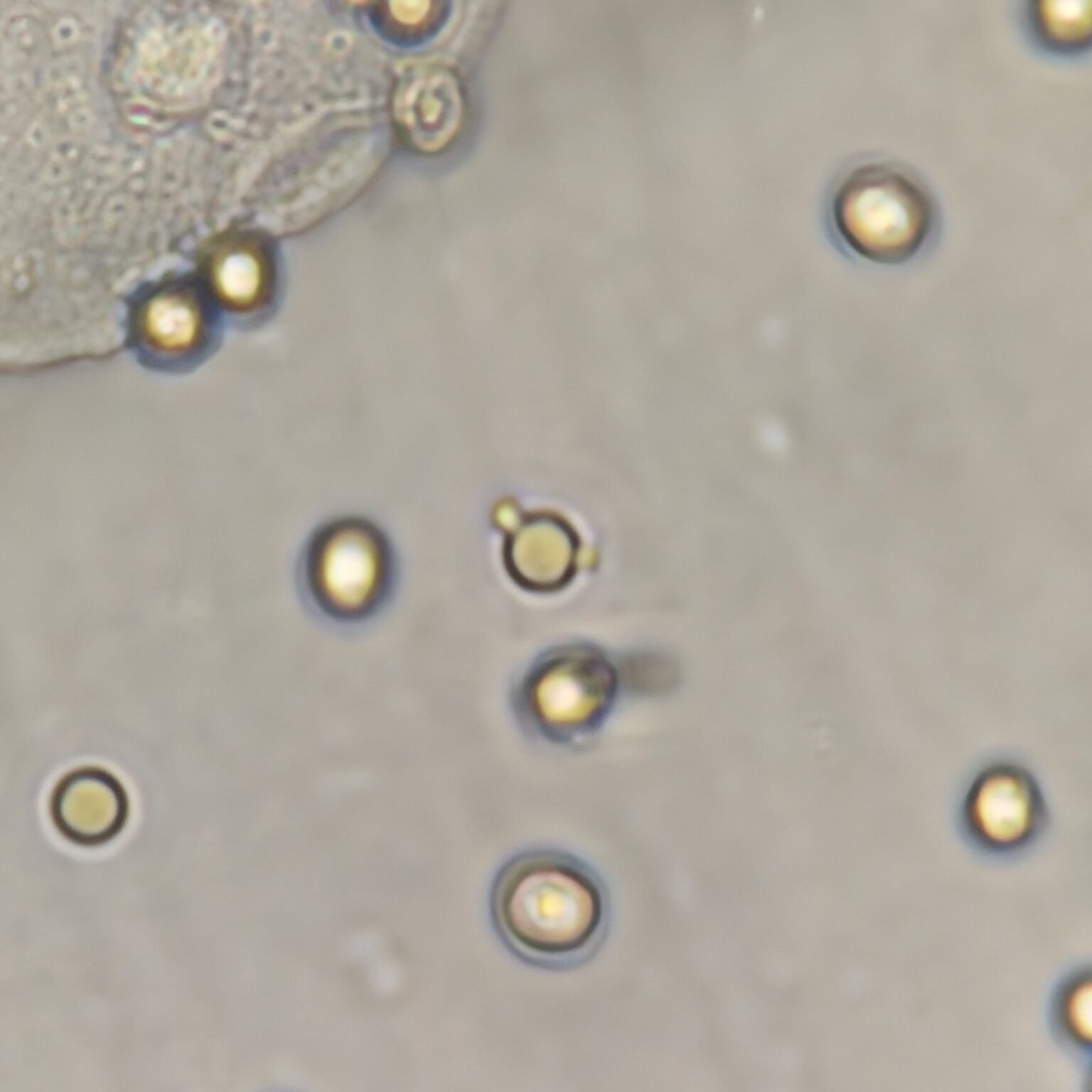 RBCs in Urine & Their Lookalikes - MedLabBuddy