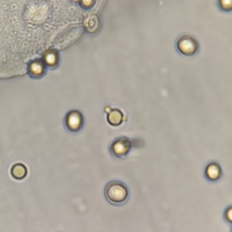 RBCs in Urine & Their Lookalikes - MedLabBuddy