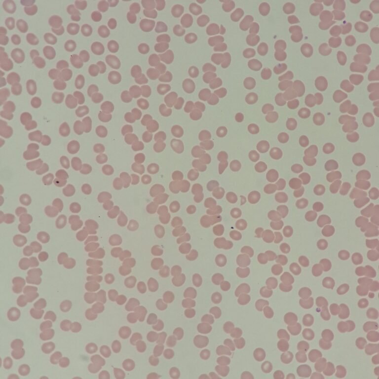 RBC Morphology Based on Shape