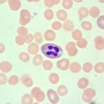 Segmented Neutrophils: Identification & Differentiation