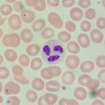 Segmented Neutrophils: Identification & Differentiation