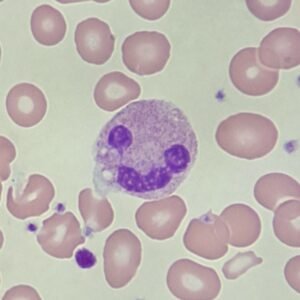 Segmented Neutrophils: Identification & Differentiation