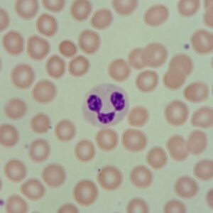 Segmented Neutrophils: Identification & Differentiation