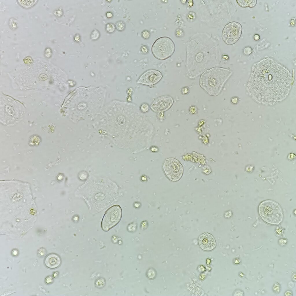 Transitional Epithelial Cells - MedLabBuddy
