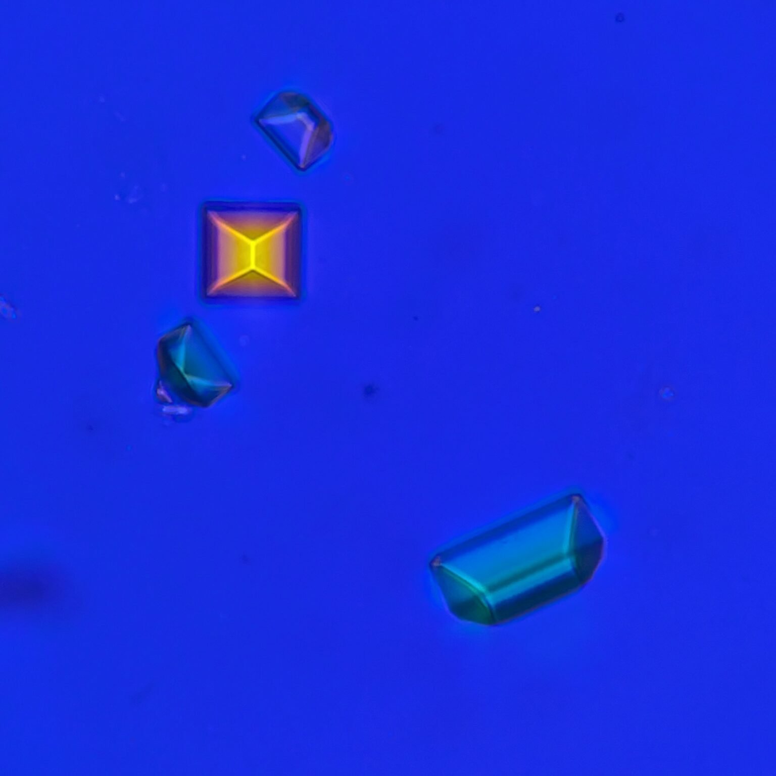 Triple Phosphate Crystals: Identification & Clinical Significance
