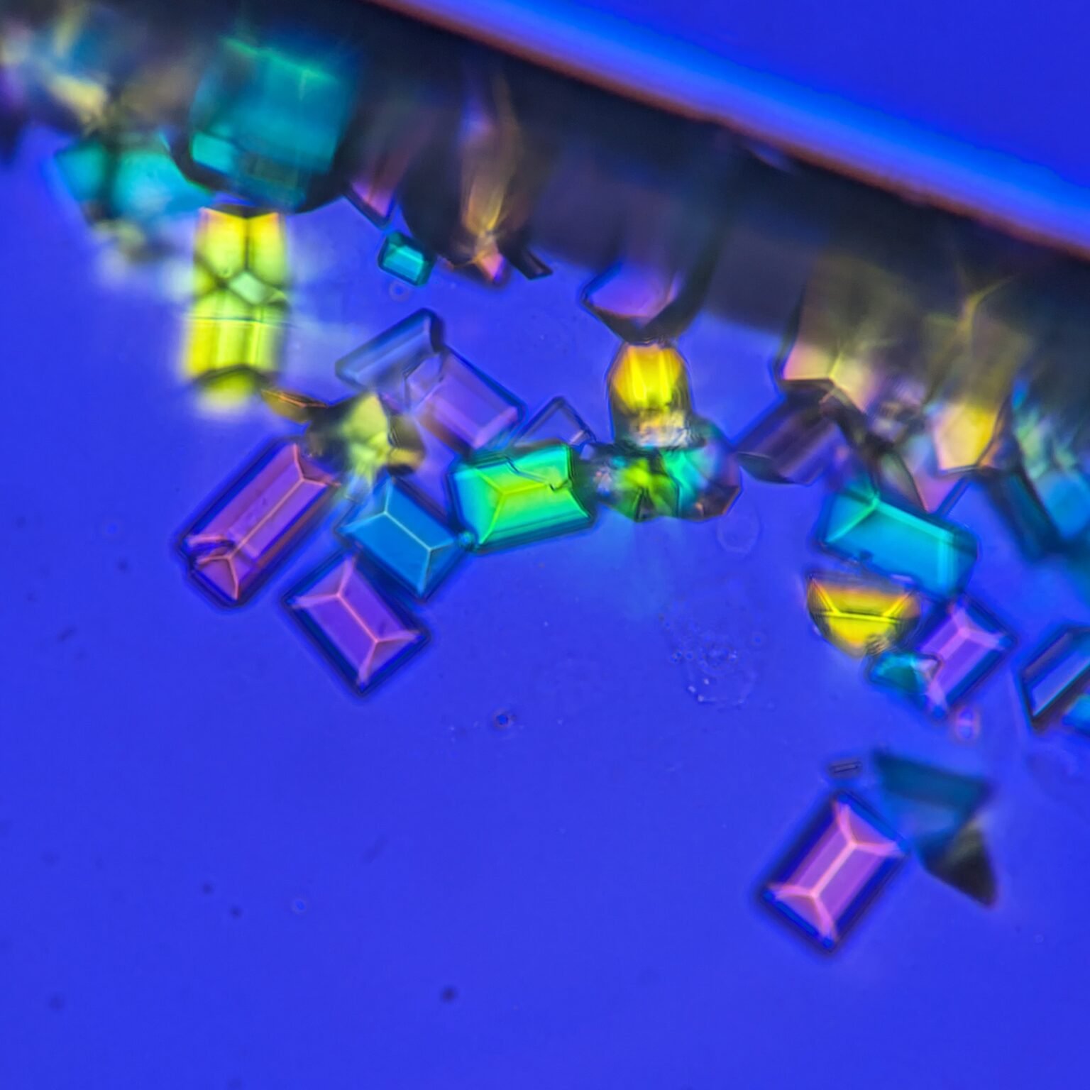 Triple Phosphate Crystals: Identification & Clinical Significance