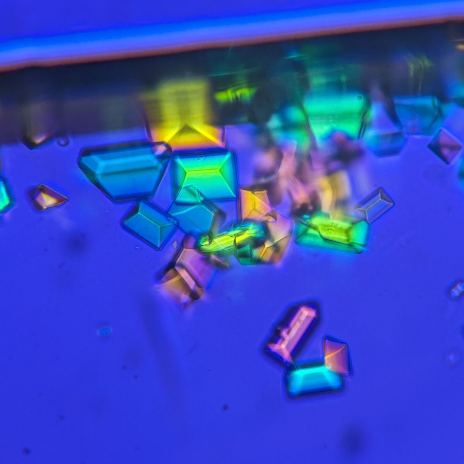 Triple Phosphate Crystals: Identification & Clinical Significance