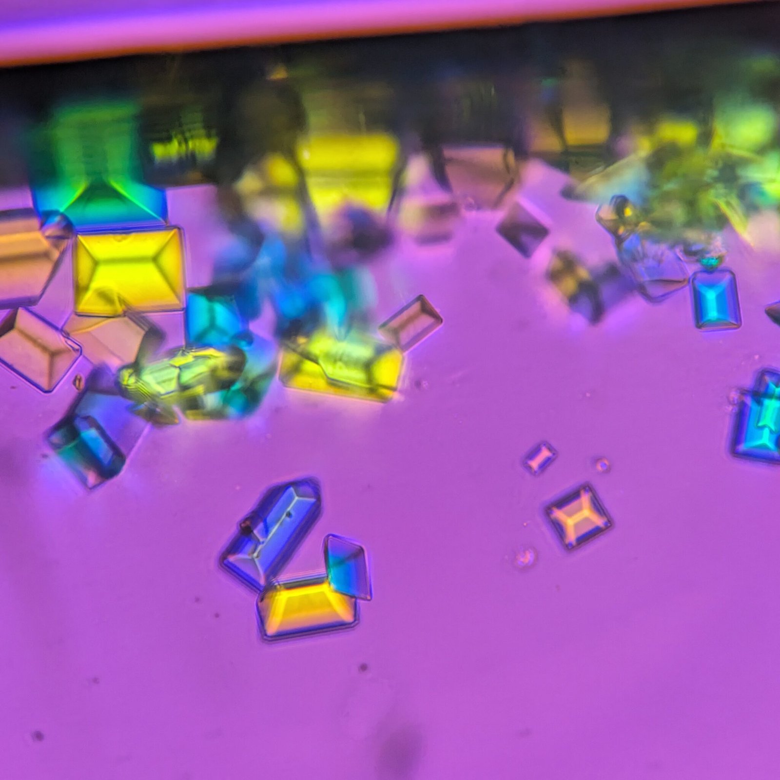 Triple Phosphate Crystals: Identification & Clinical Significance