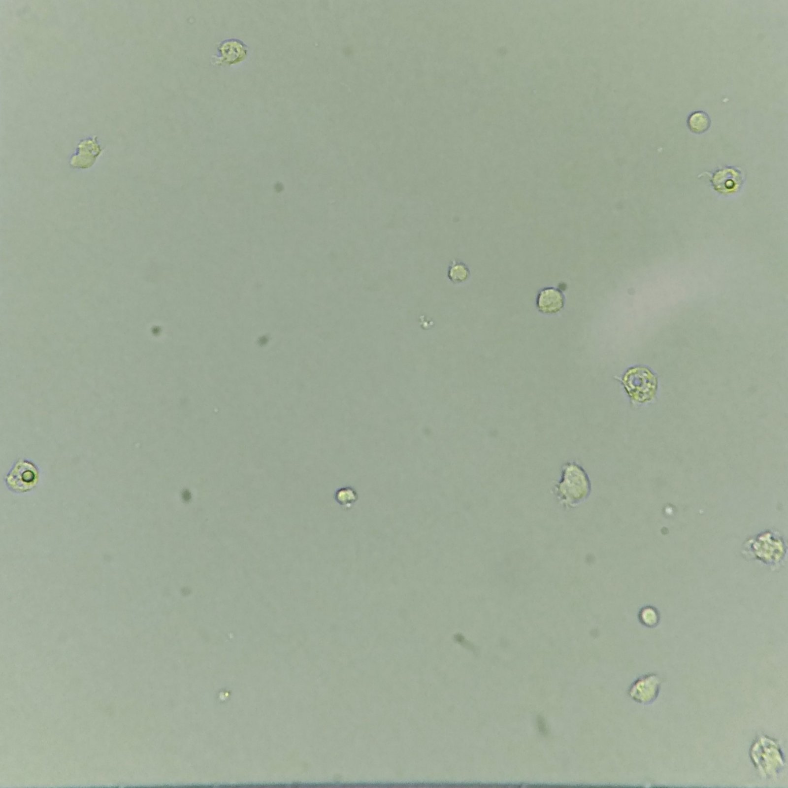 WBCs in Urine: Identification & Significance - MedLabBuddy