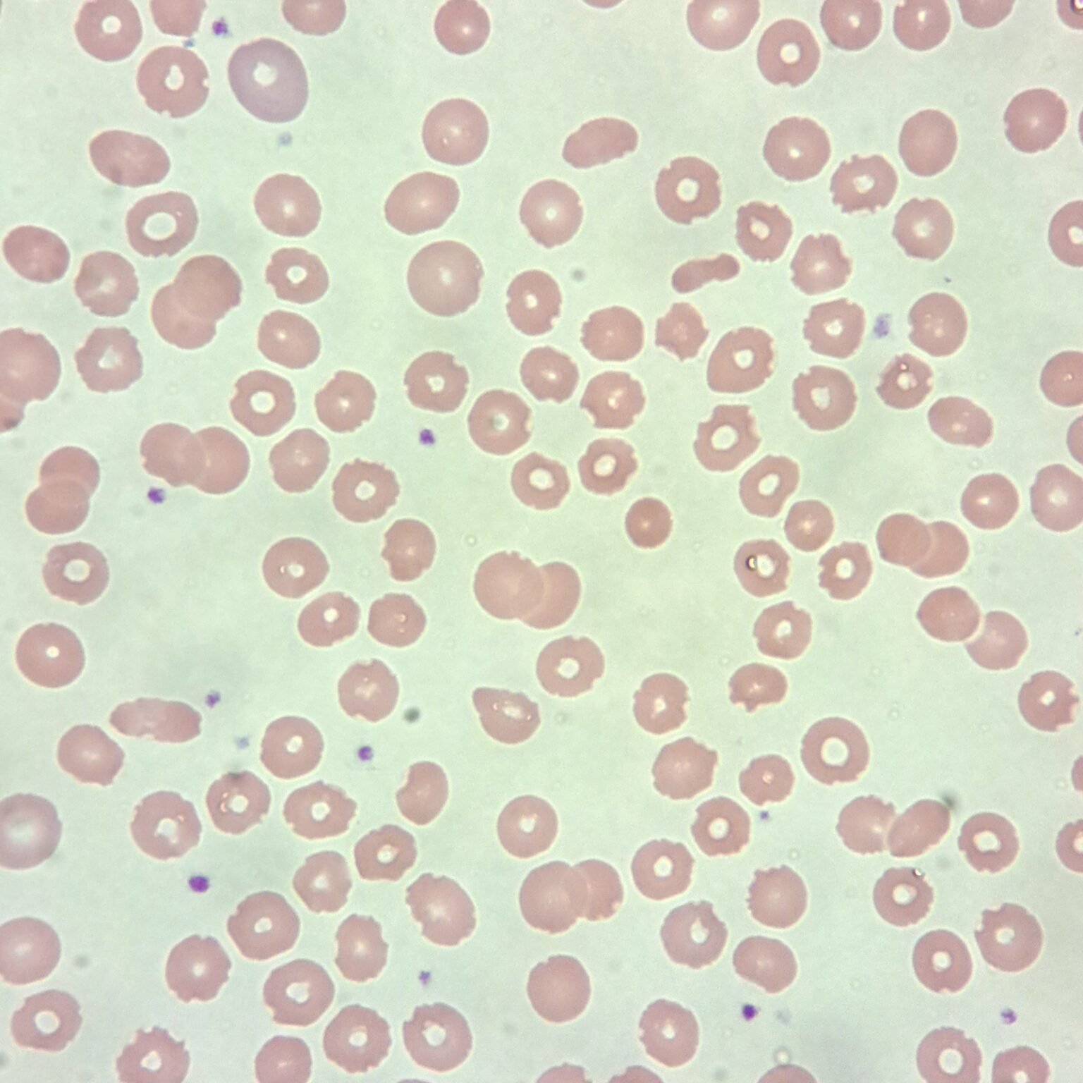 RBC Artifacts